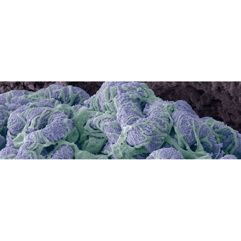 Podocyte Exact Morphology Measurement Procedure